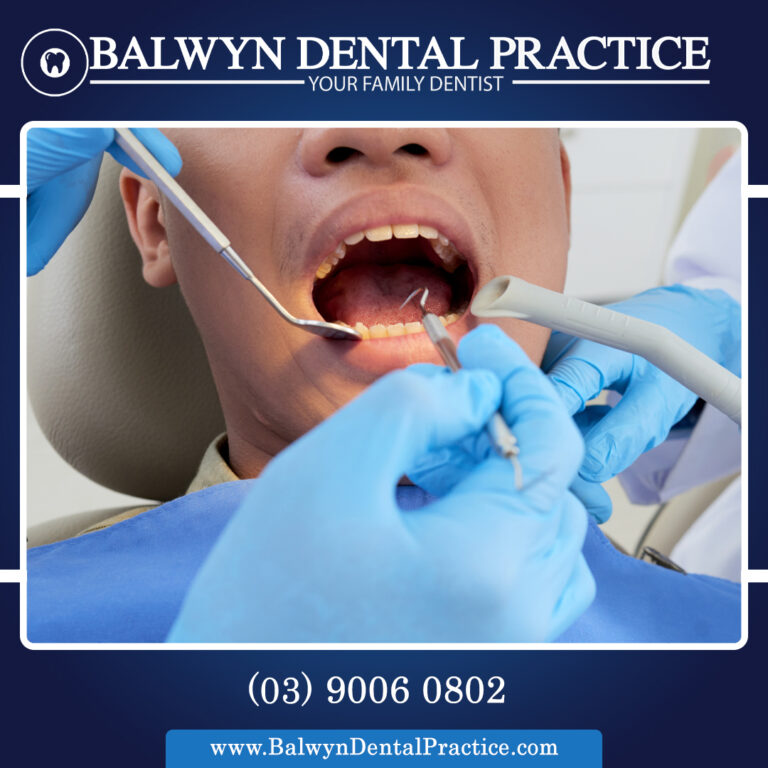Fixing A Chipped Front Tooth - Balwyn Dental Practice