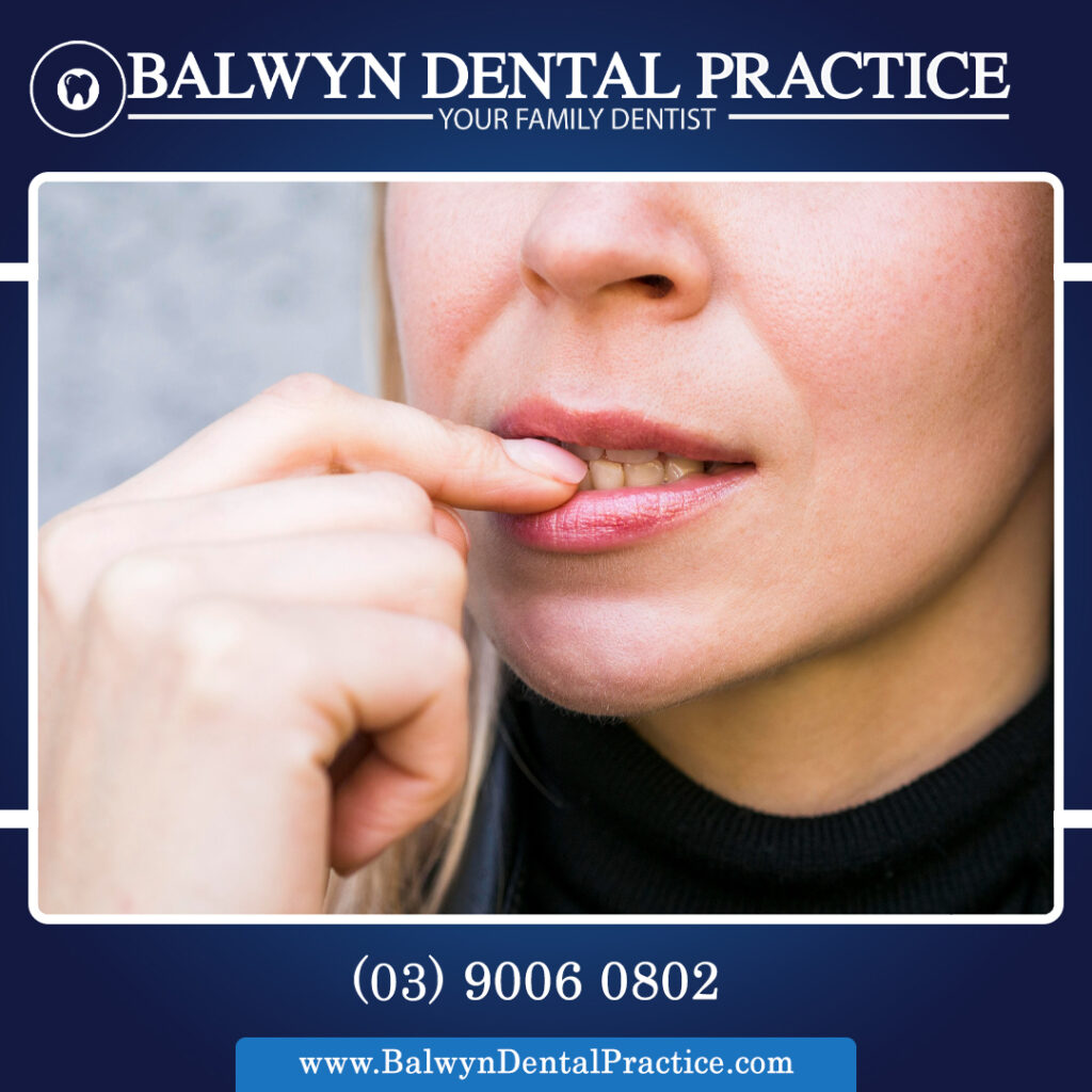 Oral Cancer - Balwyn Dental Practice